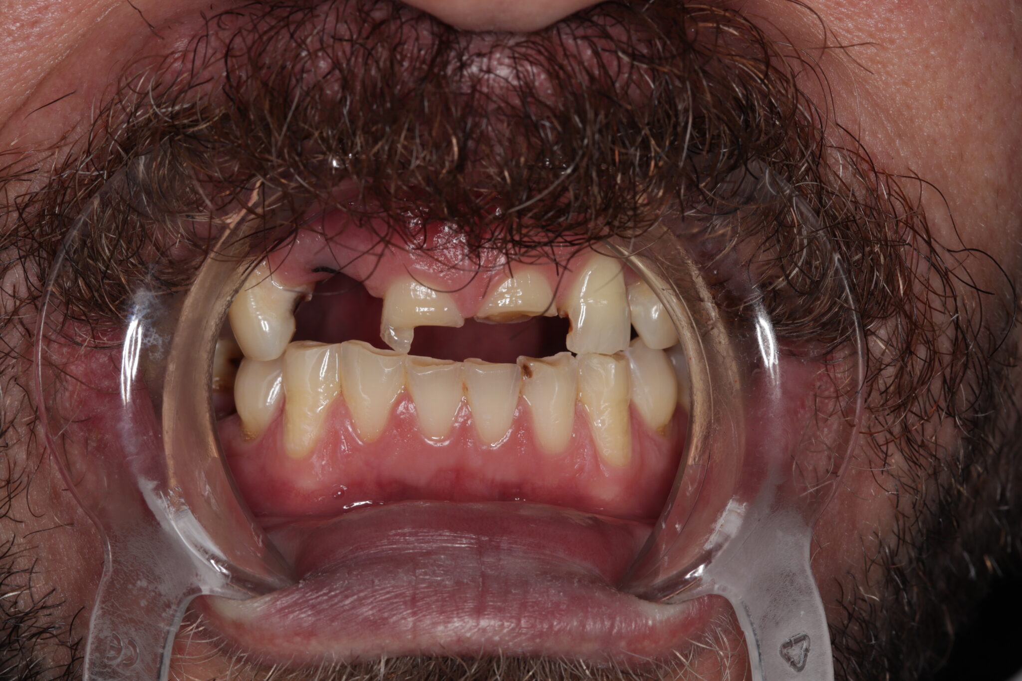 Our Services – Coolbellup Dental